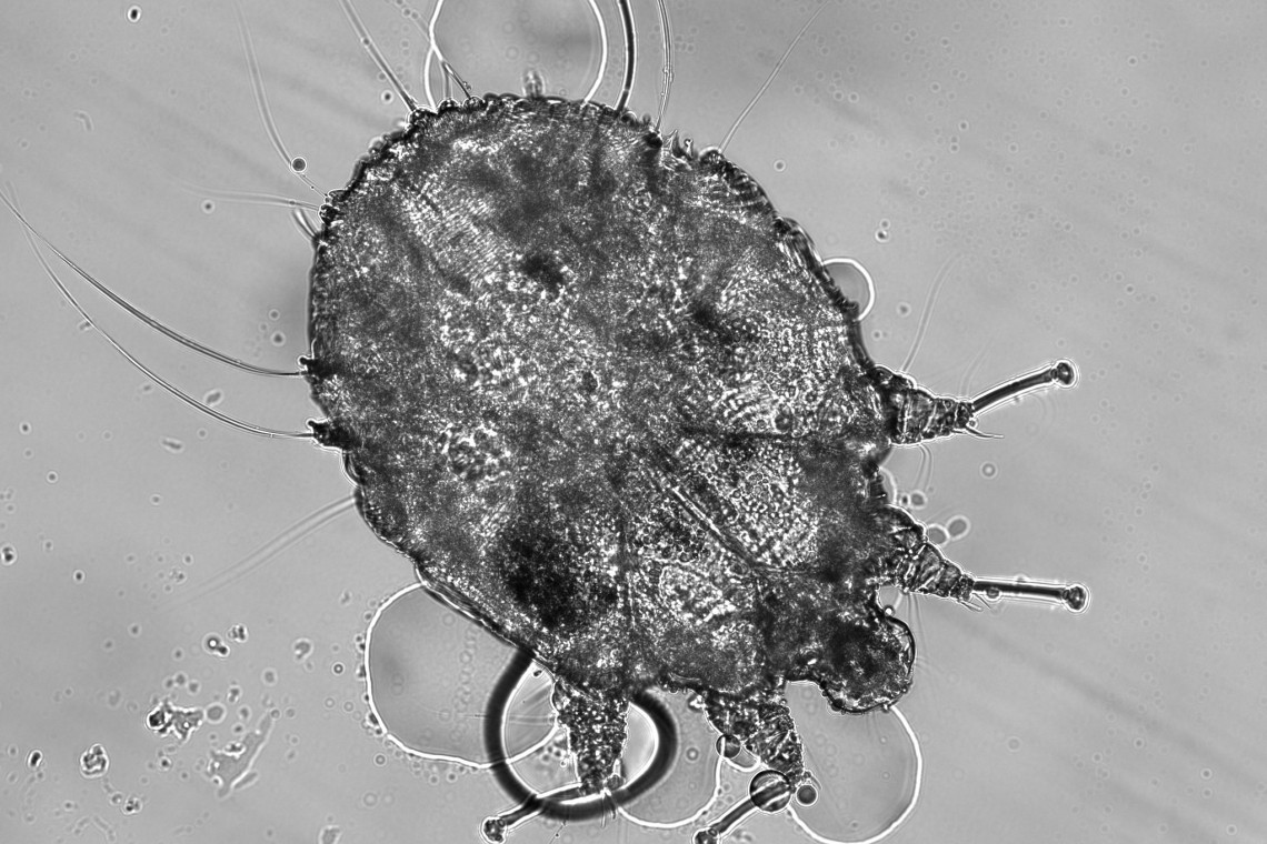 Studenten zijn populair bij de schurftmijt - U-Today